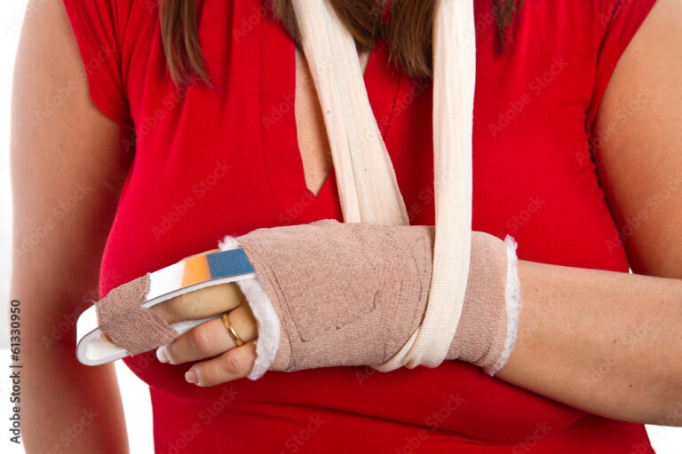 Finger Injury Leads to Good Result - Berenson Injury Law